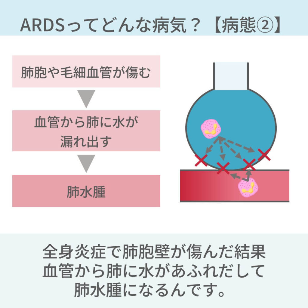 2022年9月15日 (更新日:2022年9月20日)